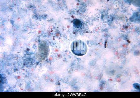Under 1150X magnification, this photomicrograph of a trichrome stained ...