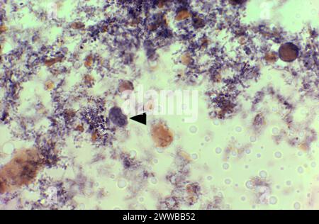 This photomicrograph of an iron-hematoxylin stained specimen revealed ...
