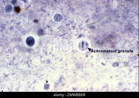 This photomicrograph of an iron-hematoxylin stained specimen revealed ...