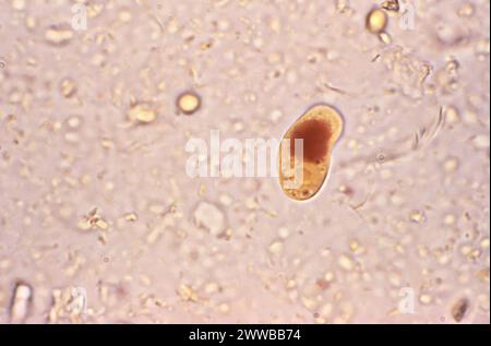 This photomicrograph of an iodine-stained specimen revealed an ...