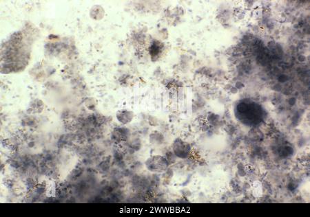 Using an iron-hematoxylin staining method, this photomicrograph reveals ...