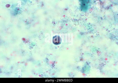 This photomicrograph of a trichrome-stained specimen revealed the ...