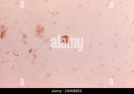 Under 500X magnification, this photomicrograph revealed the presence of ...
