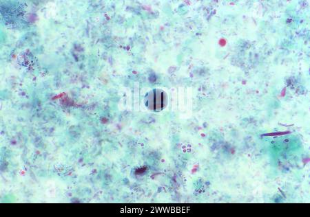 This photomicrograph of a trichrome stained specimen revealed a mature ...