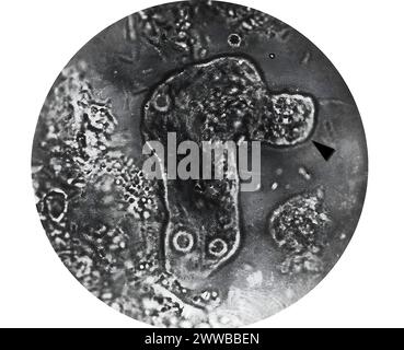 . Living anatomy and pathology; . m Stock Photo - Alamy