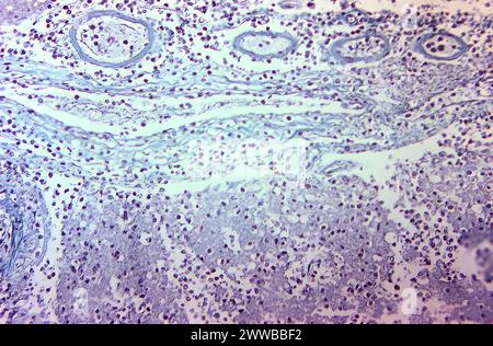 This photomicrograph of a trichrome-stained specimen revealed some of ...