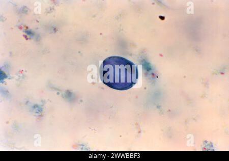 This photomicrograph of a trichrome stained specimen revealed a mature ...