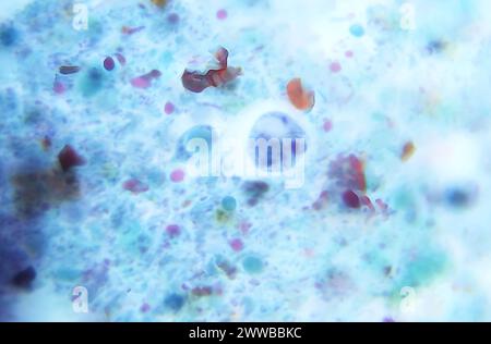This photomicrograph of a stool specimen stained with trichrome ...