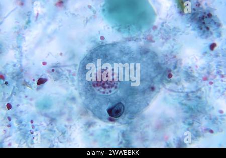 This photomicrograph of a trichrome stained specimen revealed a mature ...