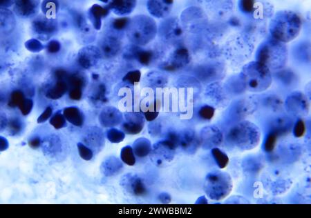 This photomicrograph of an iron-hematoxylin stained specimen revealed ...