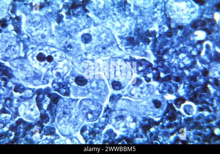 Under 900X magnification, this photomicrograph revealed the presence of ...