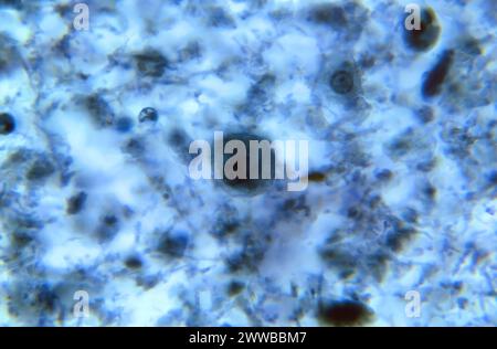 Under 900X magnification, this photomicrograph revealed the presence of ...