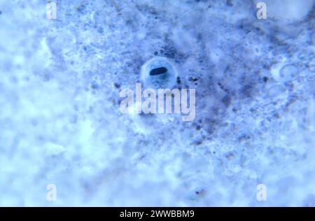Under 900X magnification, this photomicrograph revealed the presence of ...