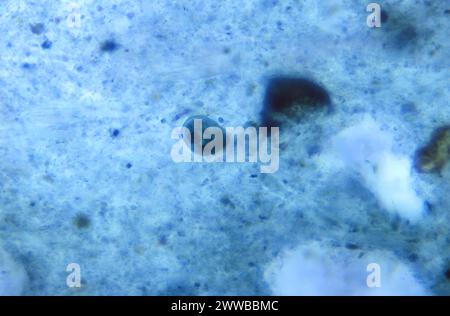Under 900X magnification, this photomicrograph revealed the presence of ...