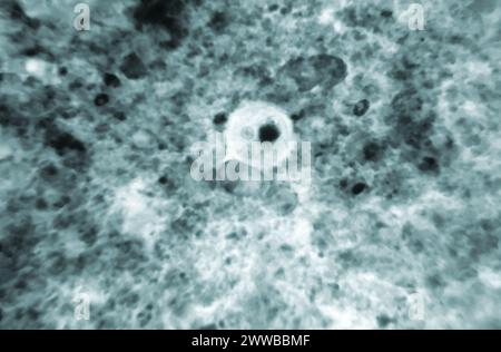 Under 900X magnification, this photomicrograph of a specimen stained ...