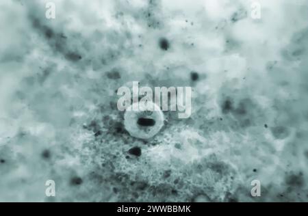 Under 900X magnification, this photomicrograph of a specimen stained ...