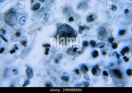 Under 900X magnification, this photomicrograph revealed the presence of ...