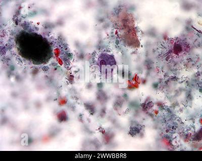 Using trichrome staining, this photomicrograph depicts a cyst of the ...