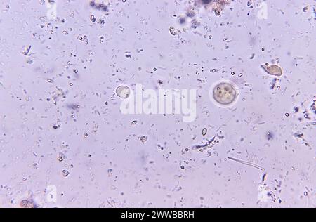 This unstained photomicrograph depicts an amoebic parasite Entamoeba histolytica cyst ...