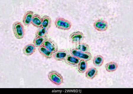 Pneumococcus (Streptococcus pneumoniae), pneumococcus is a bacteria ...