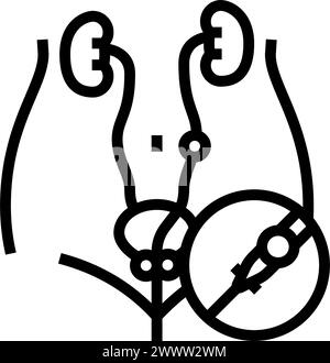 ureteroscopy urology line icon vector illustration Stock Vector Image ...