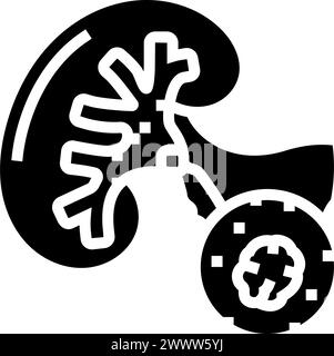 urolithiasis urology glyph icon vector illustration Stock Vector Image ...