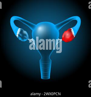 female reproductive system. Uterus anatomy. Different regions of Uterus ...