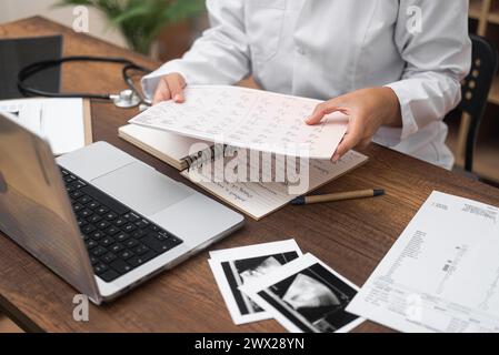 Cardiogram and Ultrasound Analysis: close-up, doctor cardiology looks ...