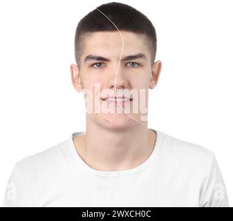 Man face divided before and after addiction treatment. Rehabilitation ...