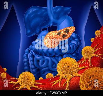 Pancreatic cancer anatomy concept and Pancreas malignant tumor symbol ...