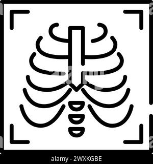 Chest x-ray showing rib cage. Medical imaging for bone and lungs health ...