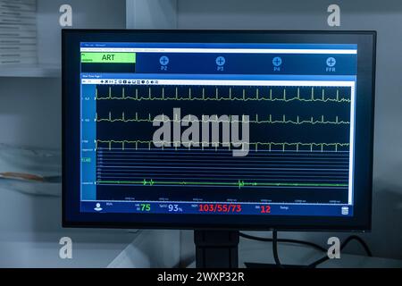 Modern equipment with vital signs monitors in operating room of ...