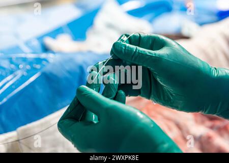 Heart stent placement process in operating room. Heart doctor inserting ...