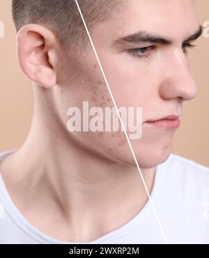 Man face divided before and after addiction treatment. Rehabilitation ...