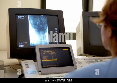 Angiography, supra-aortic trunk stenosis, interventional and vascular ...