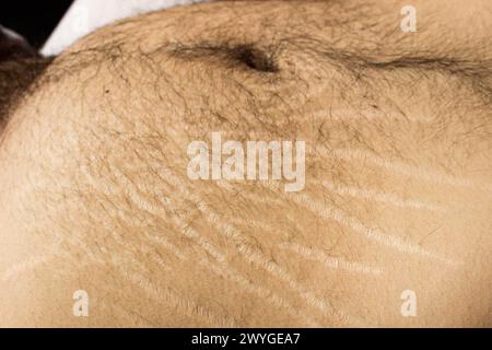 Explore the impact of weight changes, including obesity and muscle gain ...