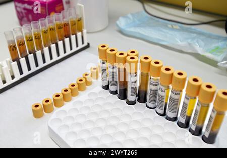 Preparation of blood samples, DNA and RNA biobank, extraction and ...