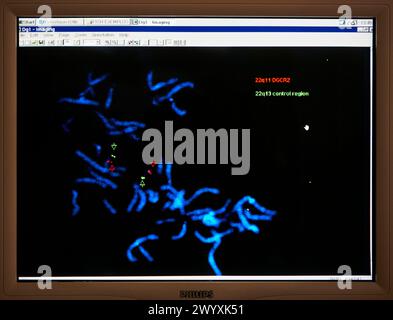 FISH (Fluorescent in situ hybridization) technique to detect the ...