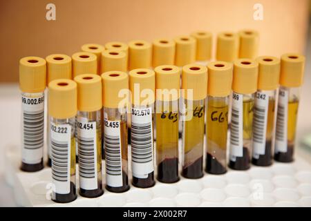 Blood samples, DNA and RNA biobank, extraction and storage of DNA/RNA ...
