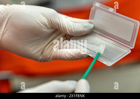 Doctor performing a cervical uterine cytology. Gynecology and health ...
