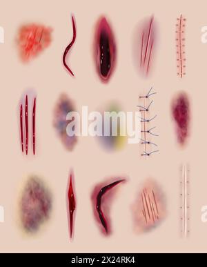 Suture icon cartoon vector. Injury skin cut. Doctor surgical tool Stock ...