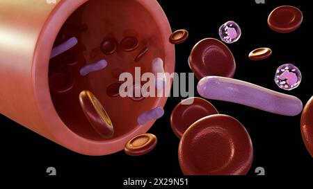 3d rendering of Septicemia, or sepsis, is the clinical name for blood ...