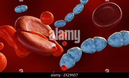 3d rendering of Septicemia, or sepsis, is the clinical name for blood ...