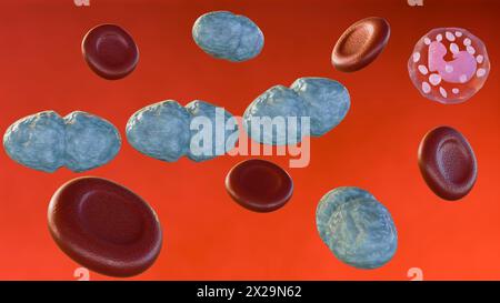 3d rendering of Septicemia, or sepsis, is the clinical name for blood ...