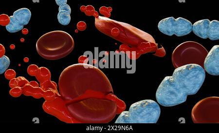 3d rendering of Septicemia, or sepsis, is the clinical name for blood ...
