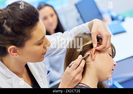 Otoplasty. winged ears. Malformation there is an absence antehelix ...