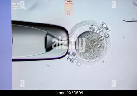 Embryology, ARU, Assisted Reproduction Unit, IVF, In Vitro ...