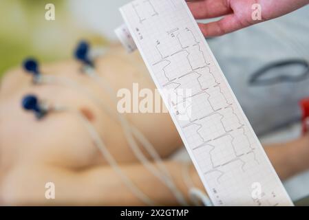 A patient undergoing an electrocardiogram test with electrodes attached ...