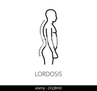 scoliosis, lordosis spine disease, back body posture defect Stock ...