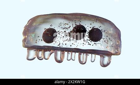 3d rendering of Osteoclasts, are the cells that degrade bone to ...